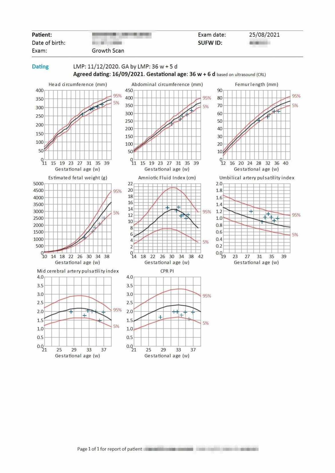 Birth Story of Atticus Kai - Mama's Got This